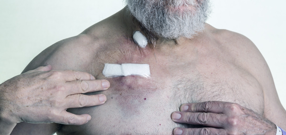 Bard Power Port | Davis & Crump